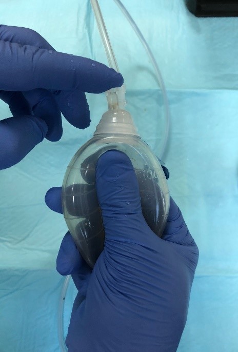 Surgical Drain Care - Maher A. Abbas, MD | Proctology, Colonoscopy