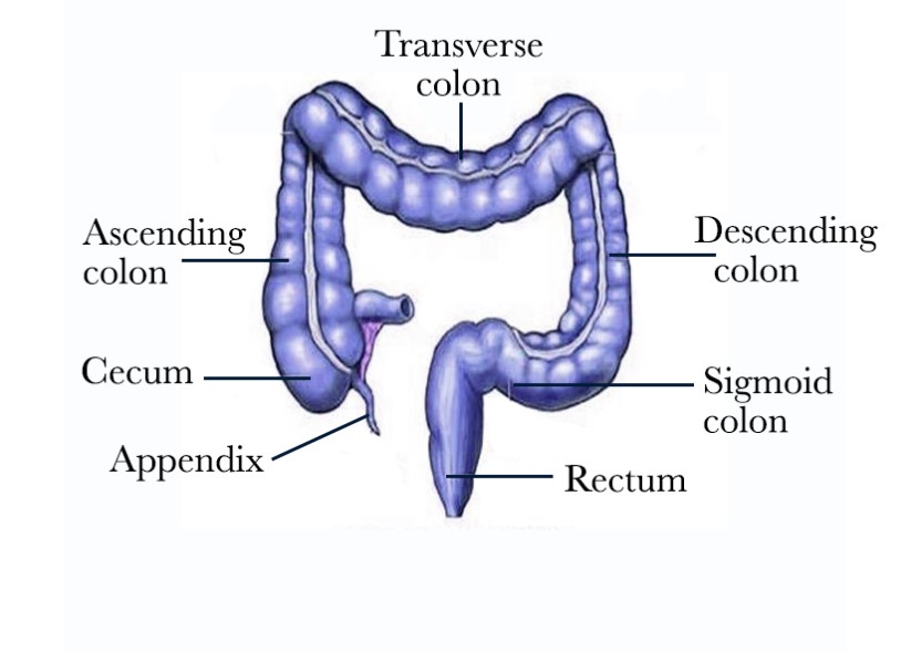 Hereditary Colorectal Cancer - Maher A. Abbas, MD | Dubai/UAE